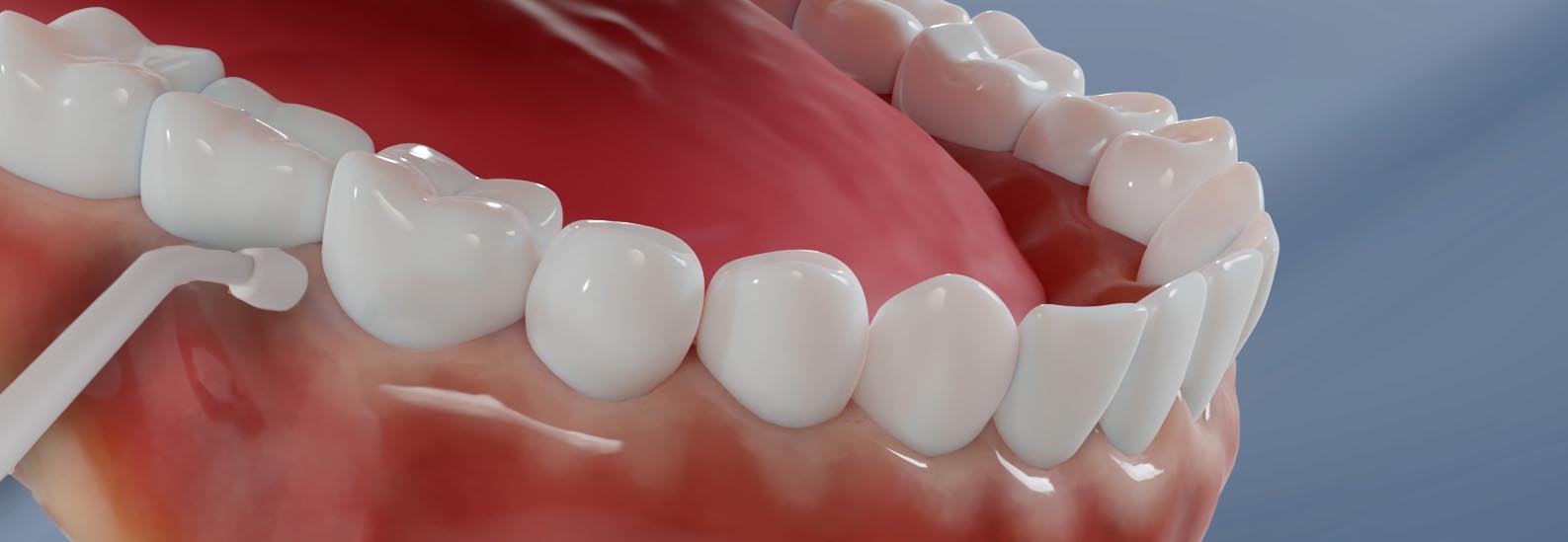 Beyond Brushing: How to Floss with Proper Technique - Dental Care of ...